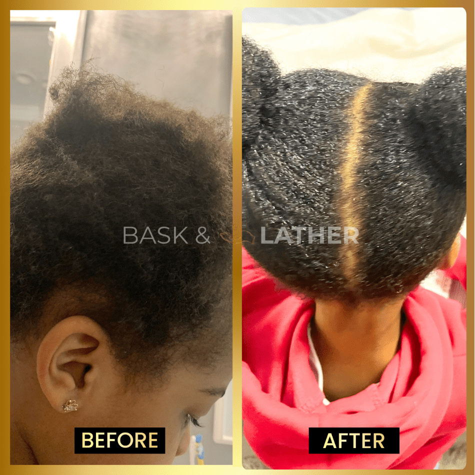 Hair Balm - Stimulating Scalp & Hair Balm | Butter Balm for Hair – Bask ...
